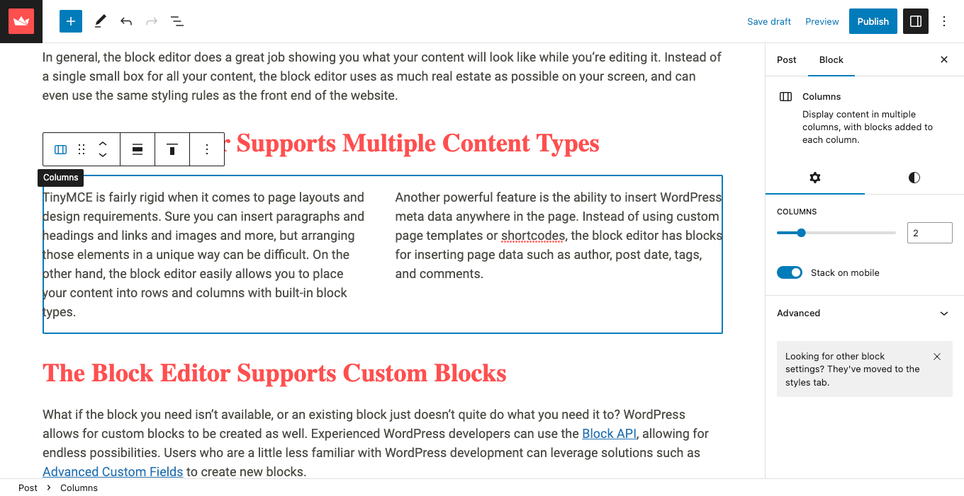 Why You Should Migrate to the WordPress Block Editor - Jordan Crown